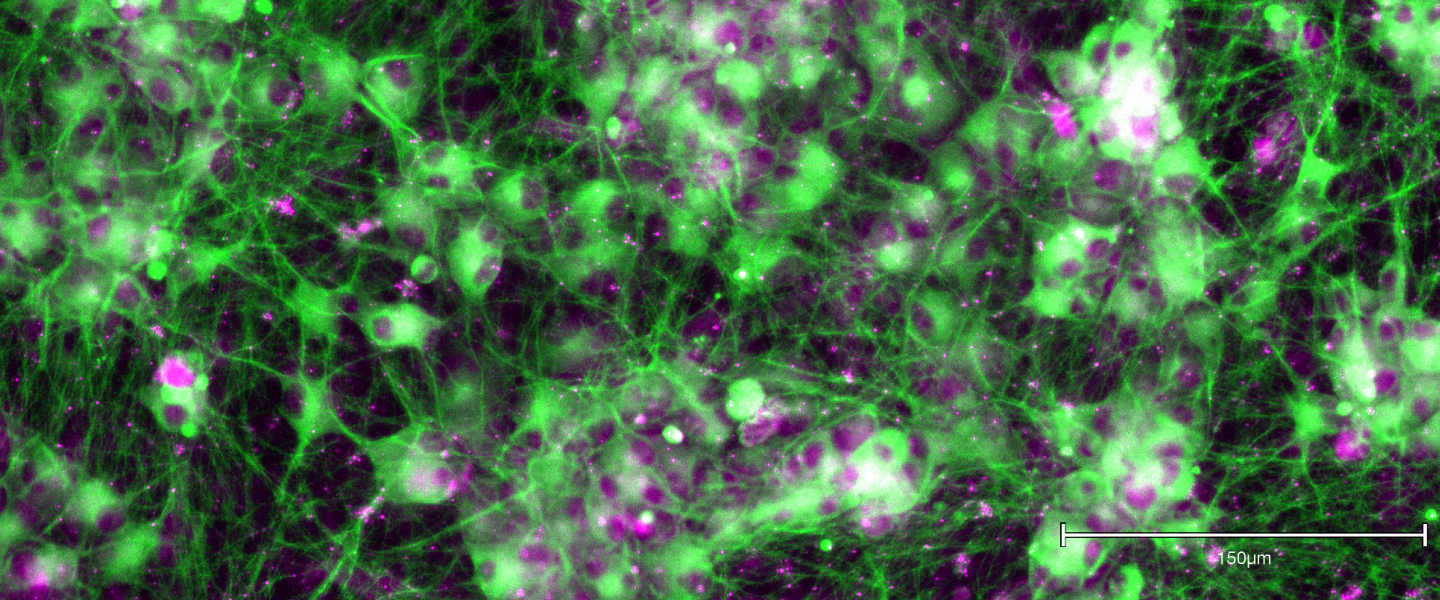 What are iPS cells? | My Peace: Personal iPS Stem Cell Banking Service